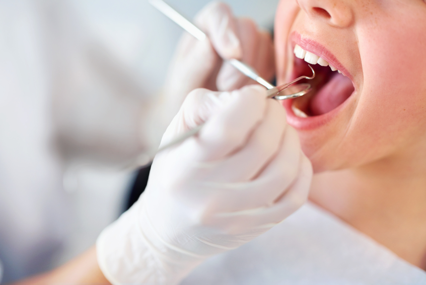 How Your Bowling Green Dentist Helps Your Tooth Decay - Dr. Utz DDS